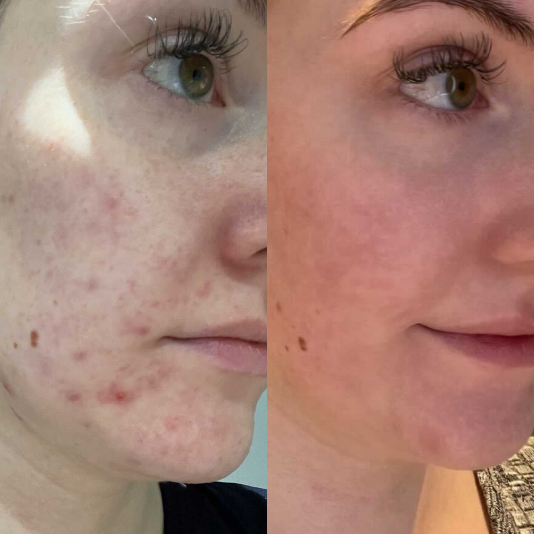 Anti-Stress Skincare Serum | Crème Rescue Serum with Neurophroline™